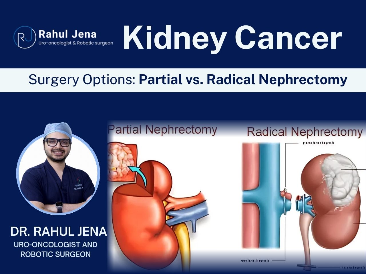 Kidney Cancer Surgery Options Partial Vs Radical Nephrectomy Dr